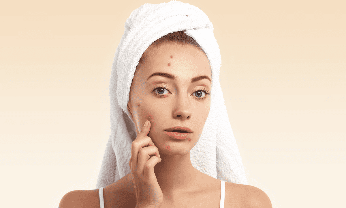 Break Up with Breakouts: The Best Sheets for Acne-Prone Skin